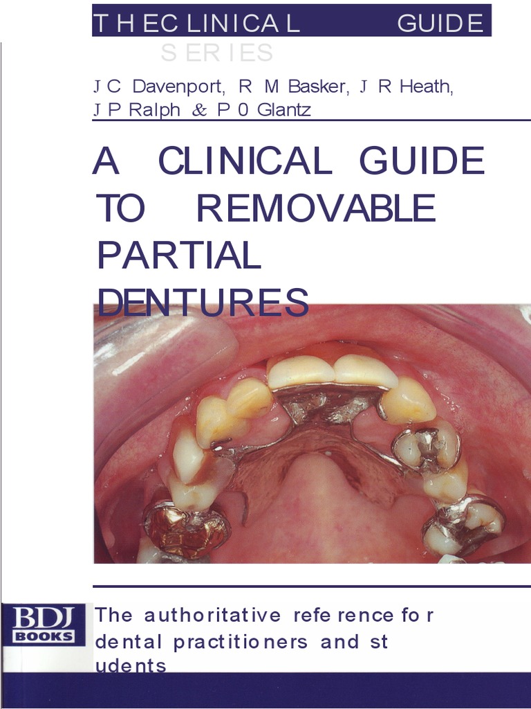 Removable Partial Denture Design