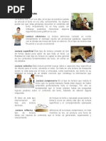 Tipos y Definición de Lectura Oral | PDF