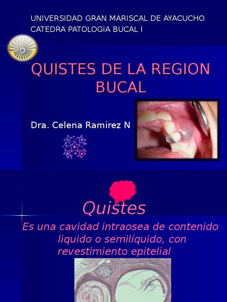 Quistes De La Region Bucal Pdf Diente Humano Medicina
