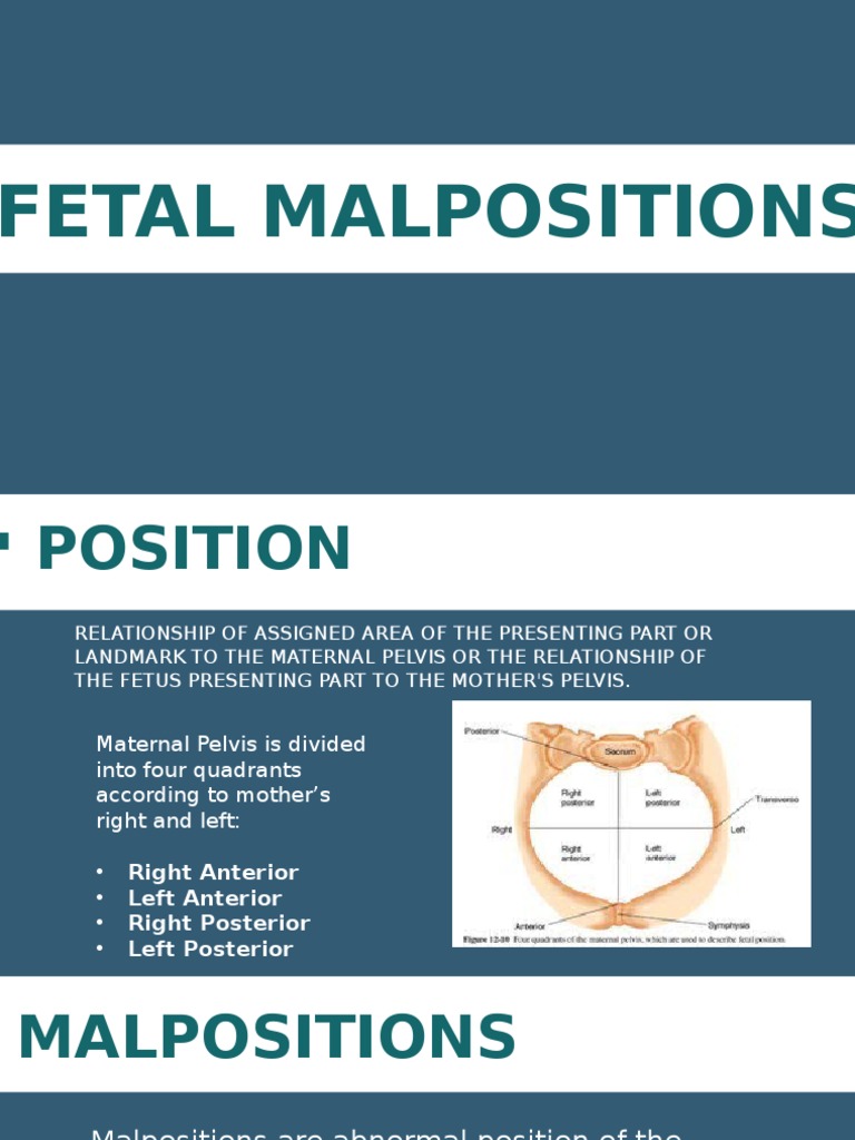 Fetal Malposition | PDF | Childbirth | Human Pregnancy