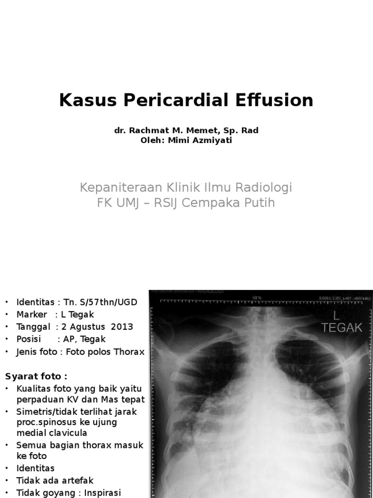 Expertise Efusi Perikard | PDF