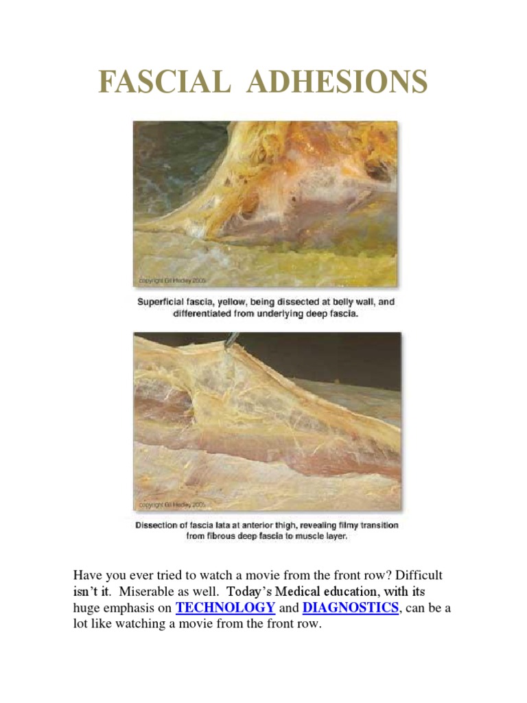 Fascial Adhesions | PDF | Tendon | Collagen