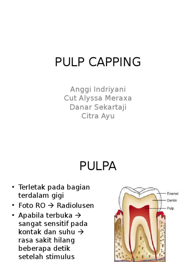 Pulp Capping | PDF