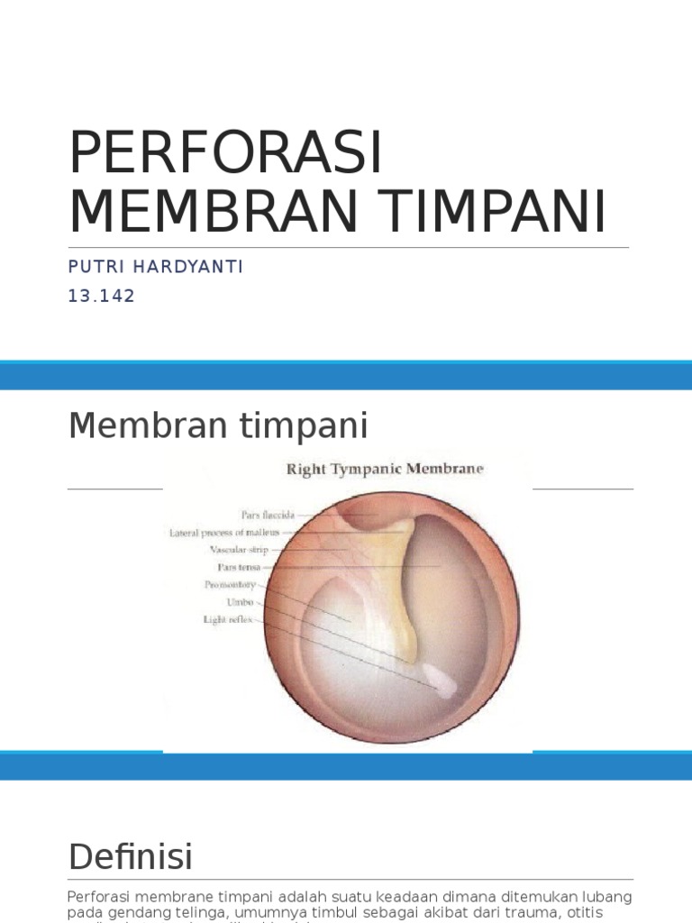 Perforasi Membran Timpani | PDF