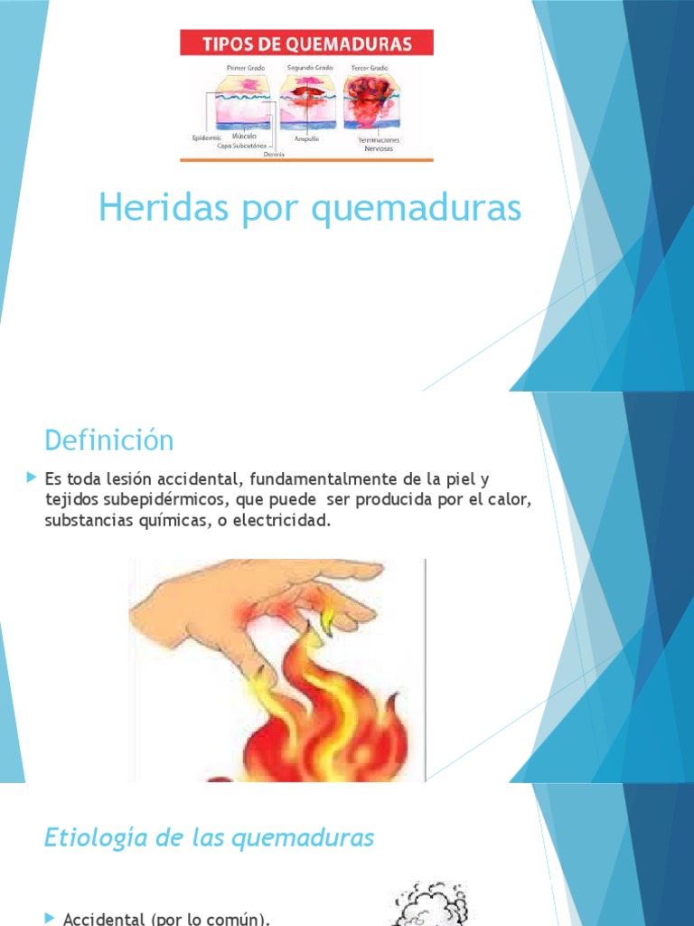 Heridas Por Quemaduras | Quemar | Herida
