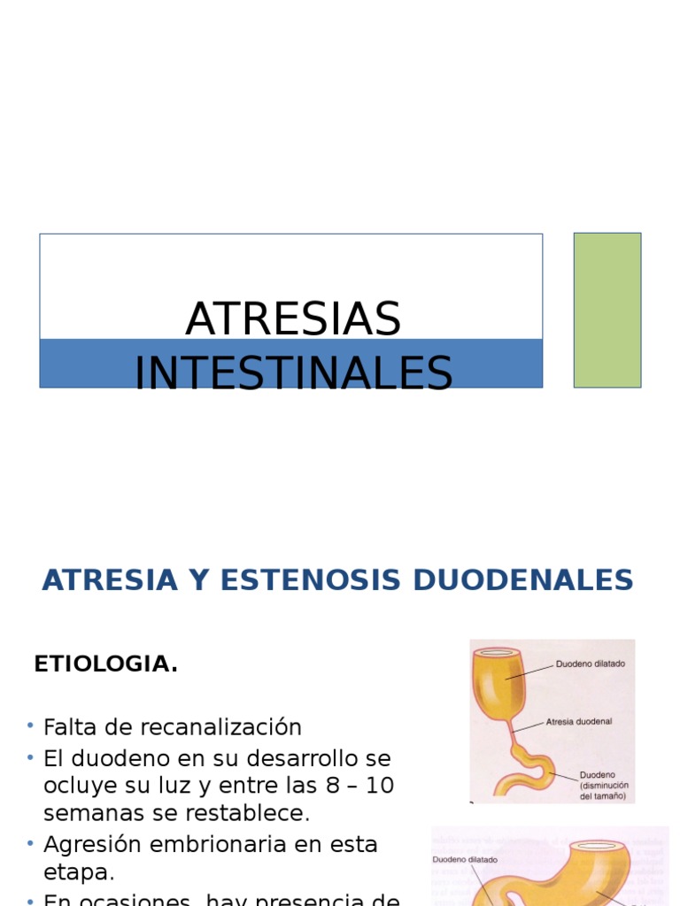 Atresias Intestinales | PDF | Abdomen | Estómago