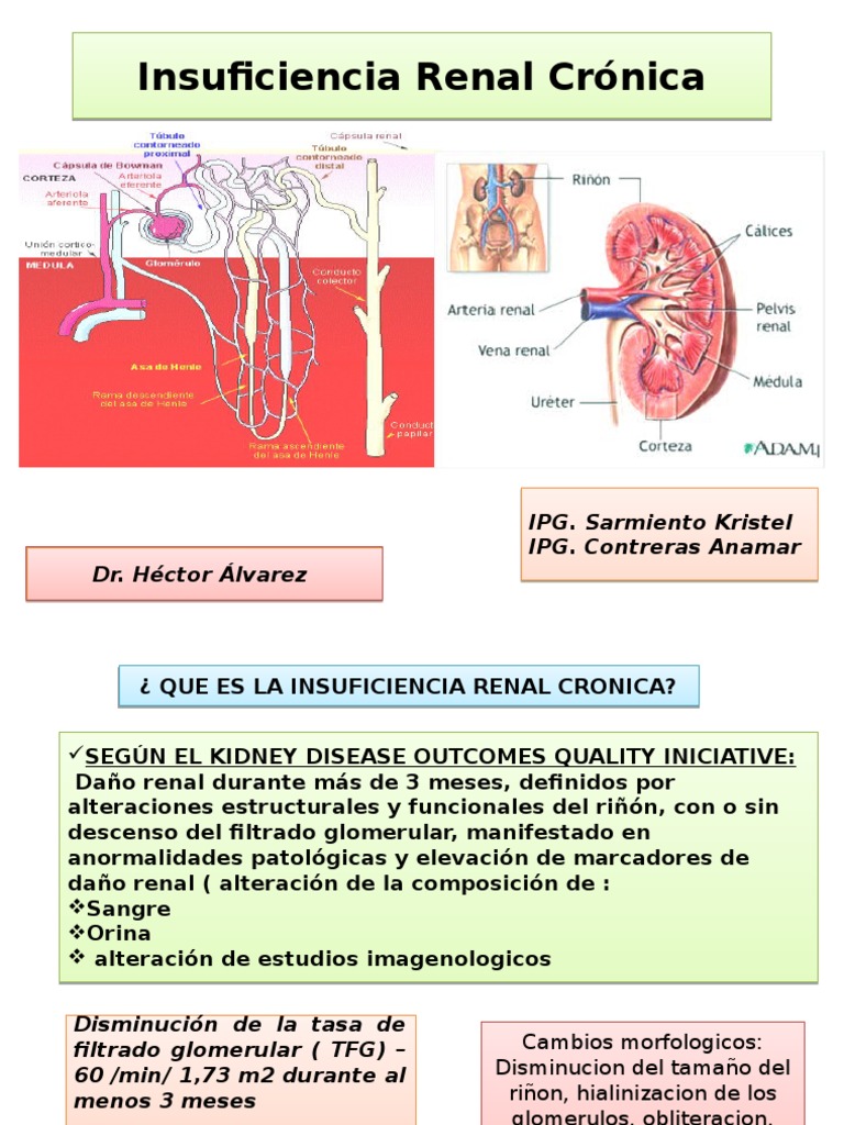 Insuficiencia Renal Cronica 1