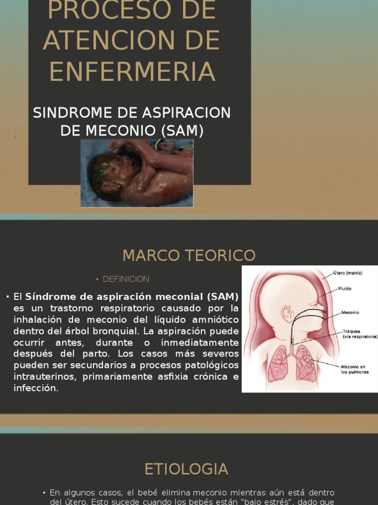 Síndrome de Aspiración Meconial | Parto | Especialidades Medicas