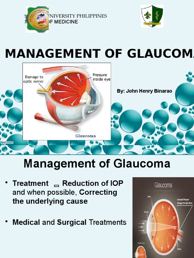 Management of Glaucoma | PDF | Glaucoma | Ophthalmology