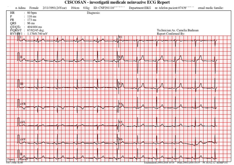 ECG Report | PDF