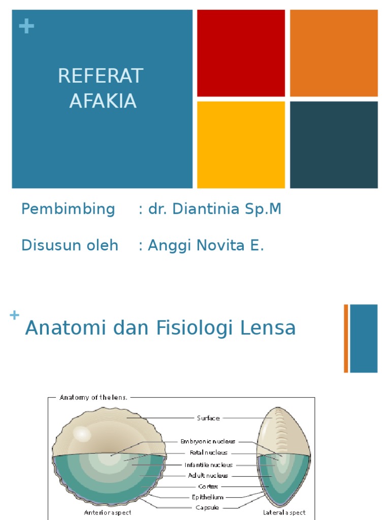Afakia, Psedofakia Dislokasi Lensa | PDF