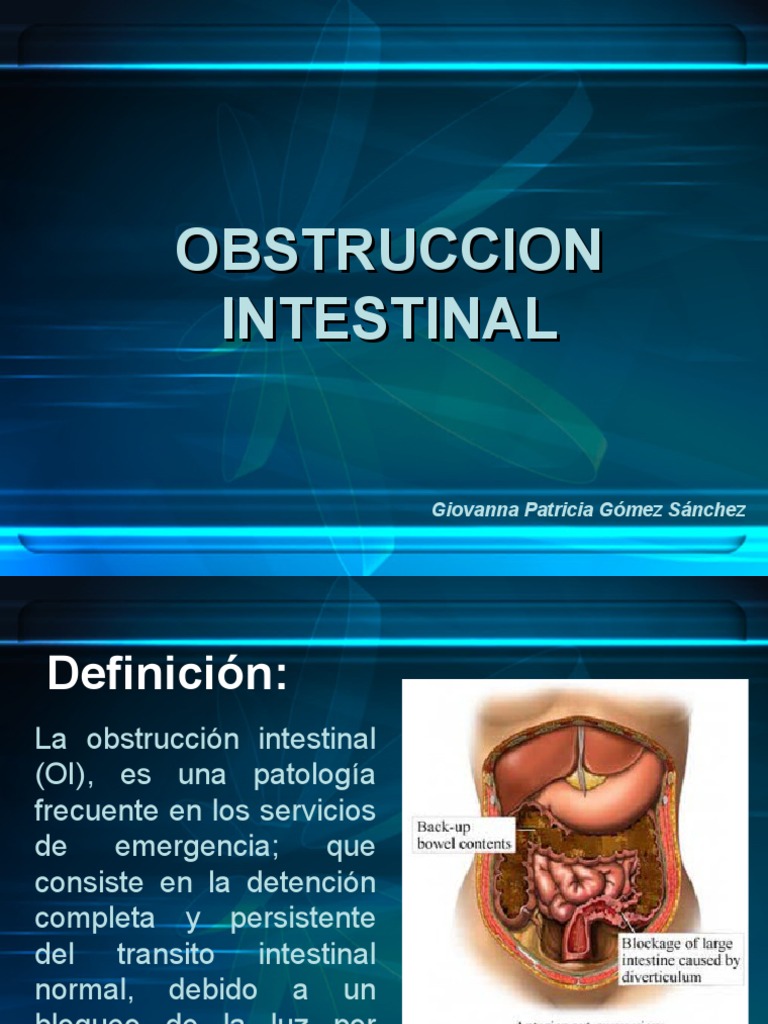Obstruccion Intestinal | PDF | Enfermedades y trastornos ...