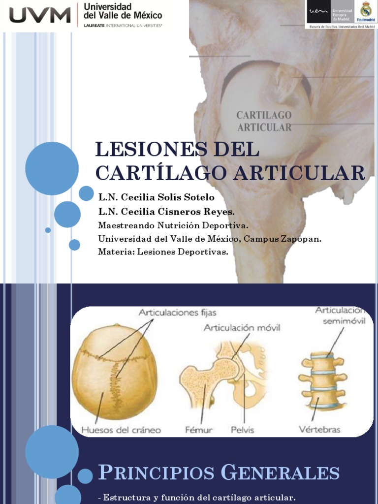 Lesiones Cartílago Articular | Cartílago | Rodilla | Prueba gratuita de ...
