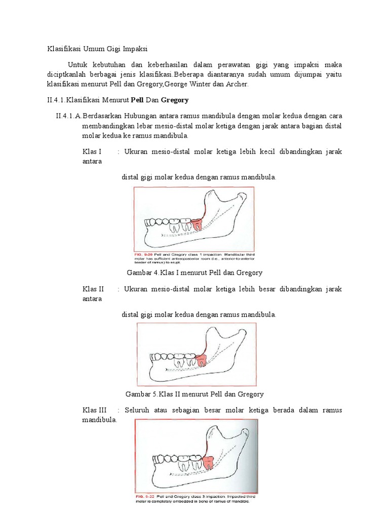 12.klasifikasi Impaksi Gigi | PDF