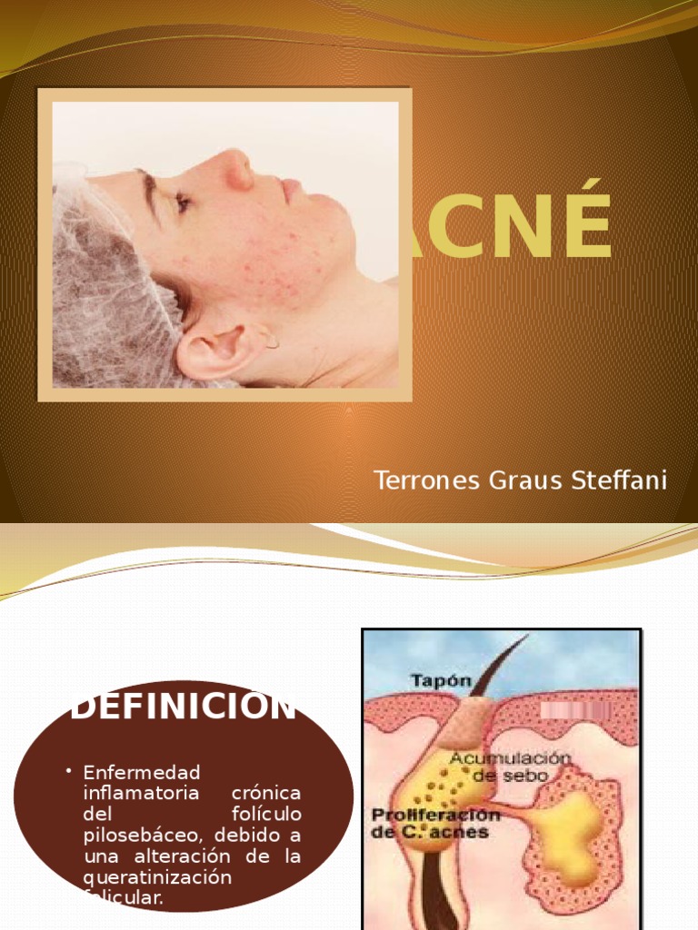 Acné Final | PDF | Acné común | Especialidades Medicas