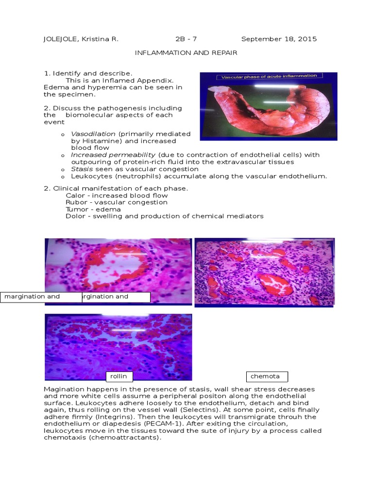 Margination and Adhesion Margination and Adhesion | PDF | Inflammation ...