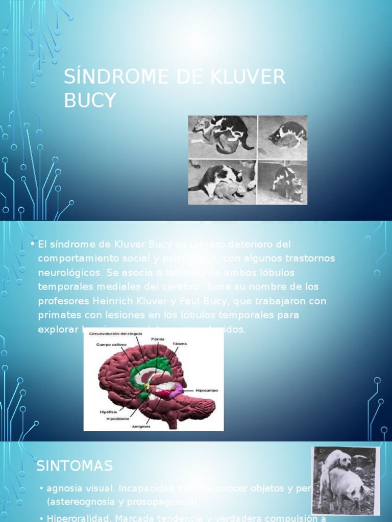 Síndrome de Kluver-Bucy y Hiperoralidad | PDF
