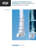 Posterior Tibial Tendon Insufficiency (PTTI) - Foot & Ankle ...