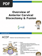 Boyd & Griffin Classification (1949) | PDF | Hip | Surgery