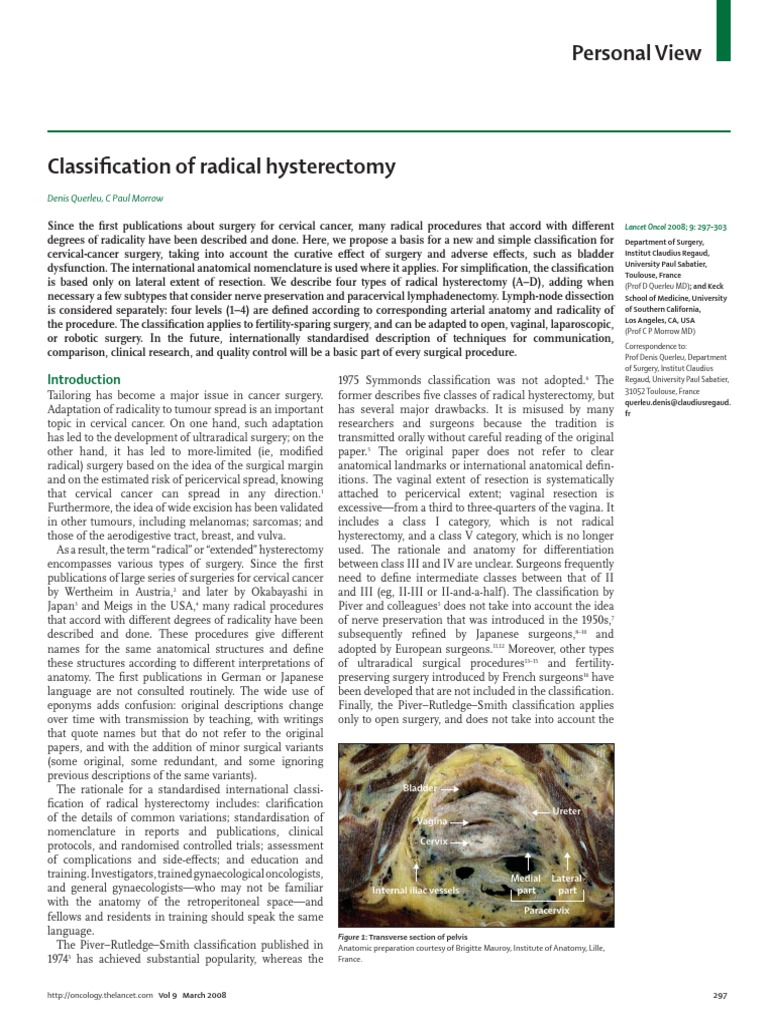 Classification of Radical Hysterectomy | PDF