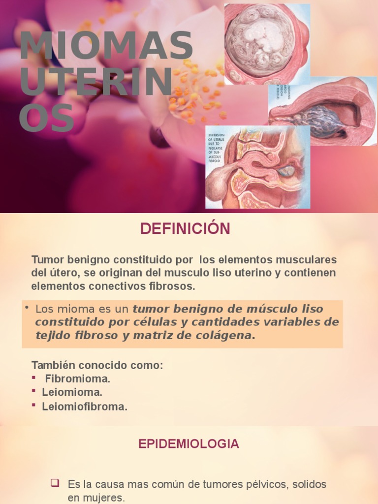Miomas Uterinos: Tipos y Síntomas | PDF | Útero | El embarazo