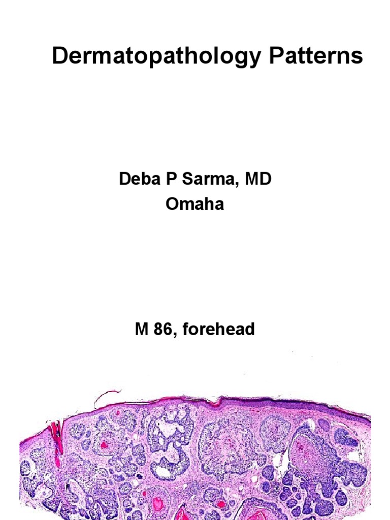 Dermatopathology Patterns