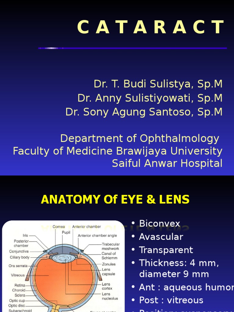 Cataract Lecturer | PDF | Cataract | Sensory Organs