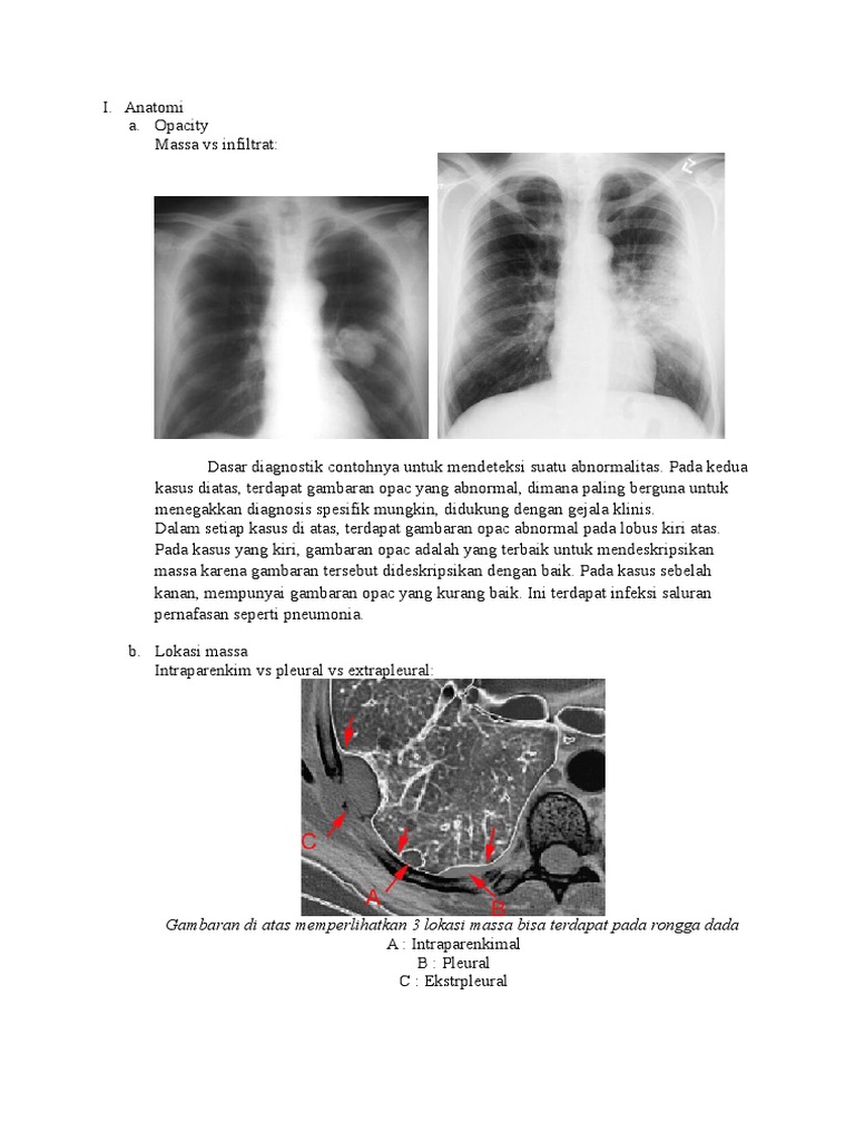 Anatomi Radiologi | PDF