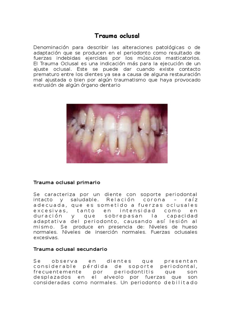 Trauma Oclusal | Diente humano | Lesión