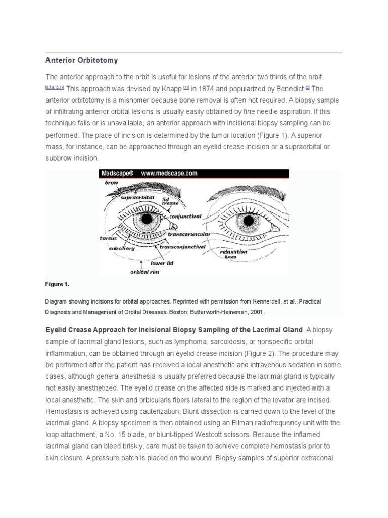 Orbitotomi Medscape | PDF | Biopsy | Anatomical Terms Of Location