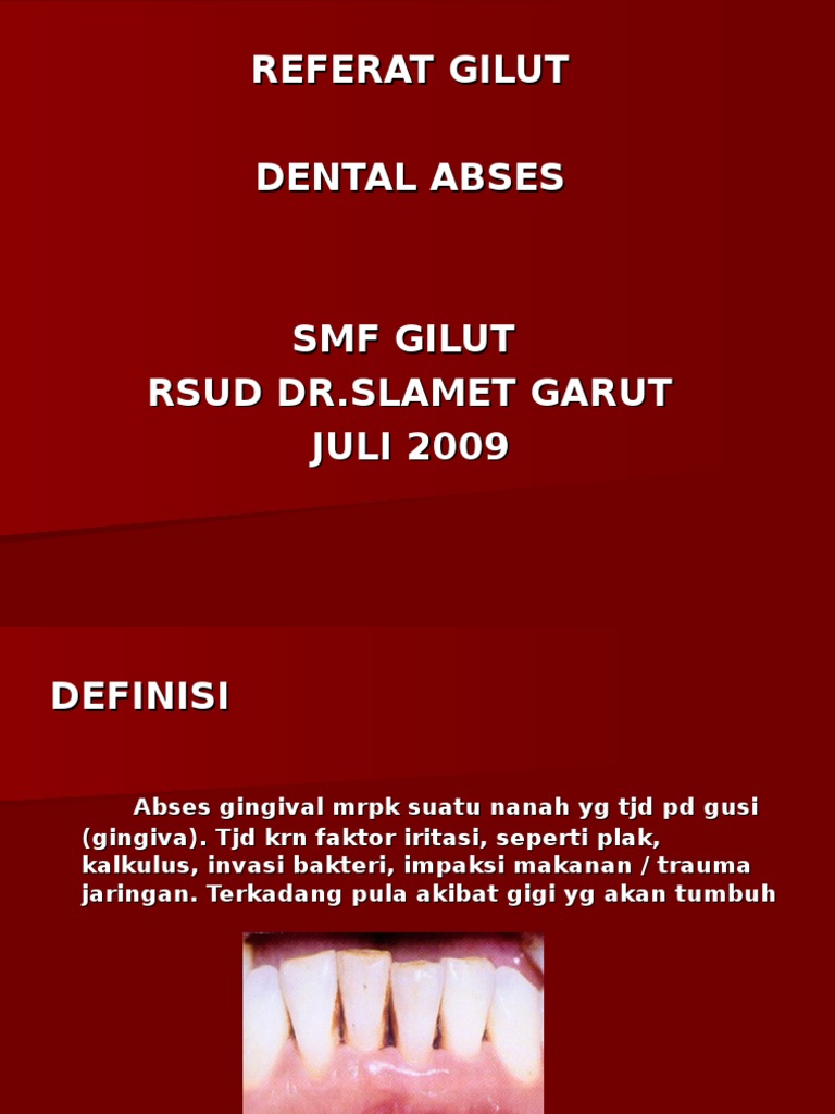 Presentasi Dental Abses | PDF