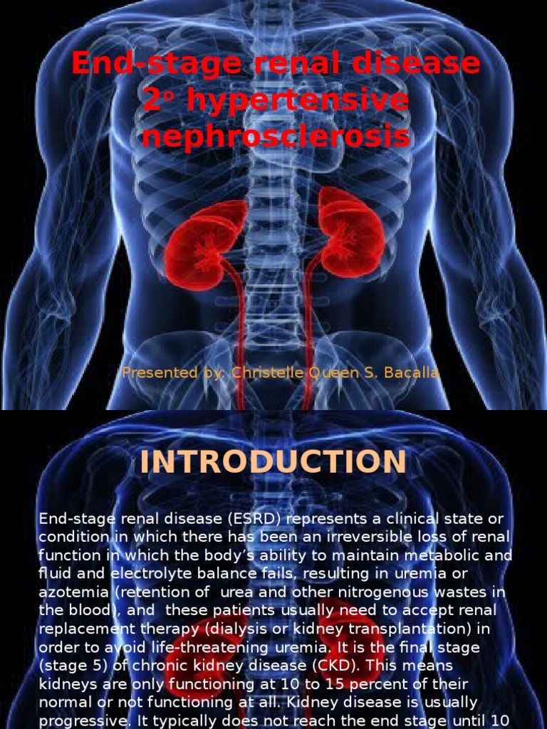 ESRD Due to Hypertensive Nephrosclerosis | PDF | Kidney | Chronic ...
