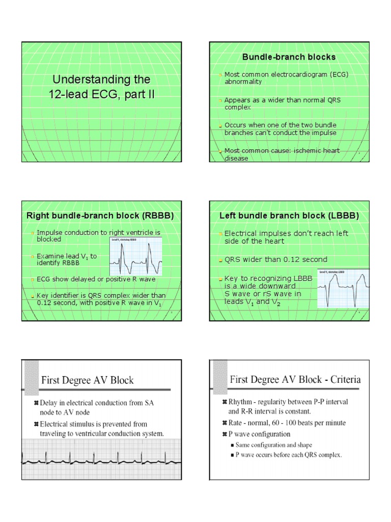 Understanding The 12 - Lead ECG, Part II | PDF | Electrocardiography ...