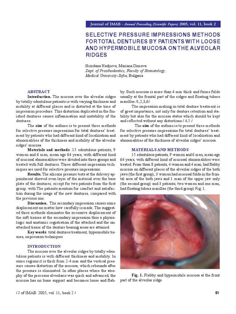 Selective Pressure Impressions Methods PDF | PDF | Dentures | Mouth