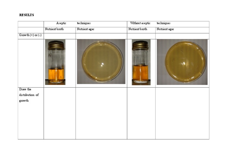 Aseptic Techniques Without Aseptic Techniques Nutrient Broth Nutrient ...