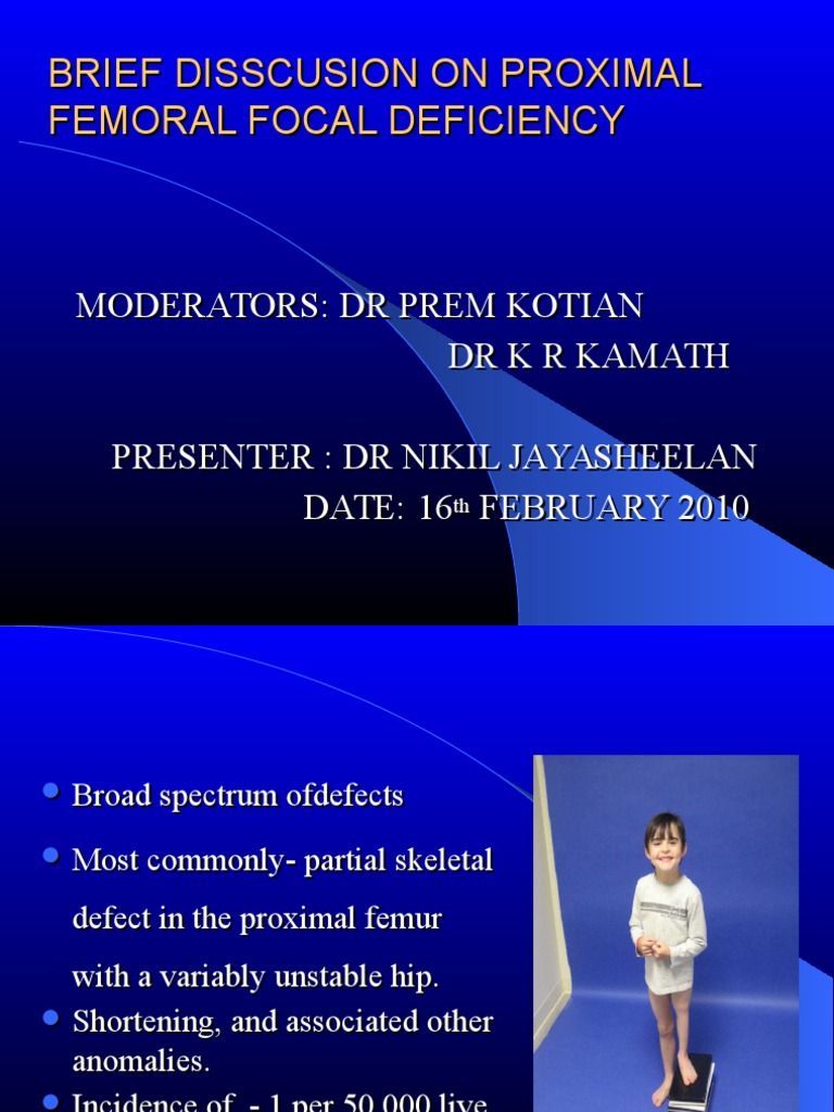 Proximal Femoral Focal Deficiency Overview | PDF | Hip | Knee