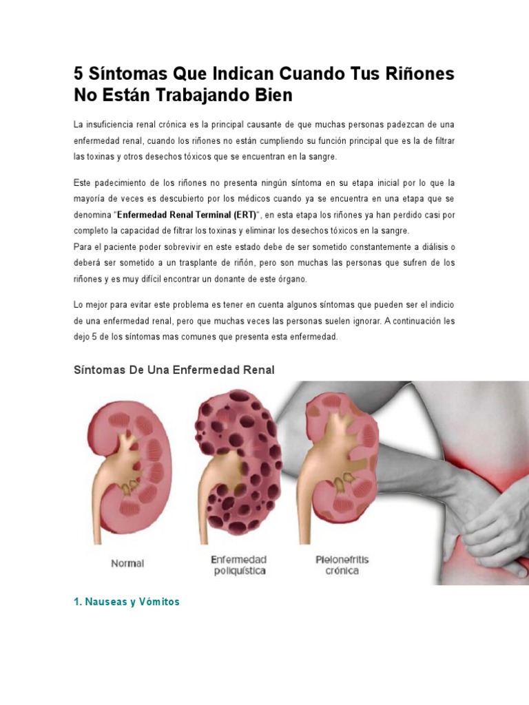 5 Síntomas Que Indican Cuando Tus Riñones No Están Trabajando Bien