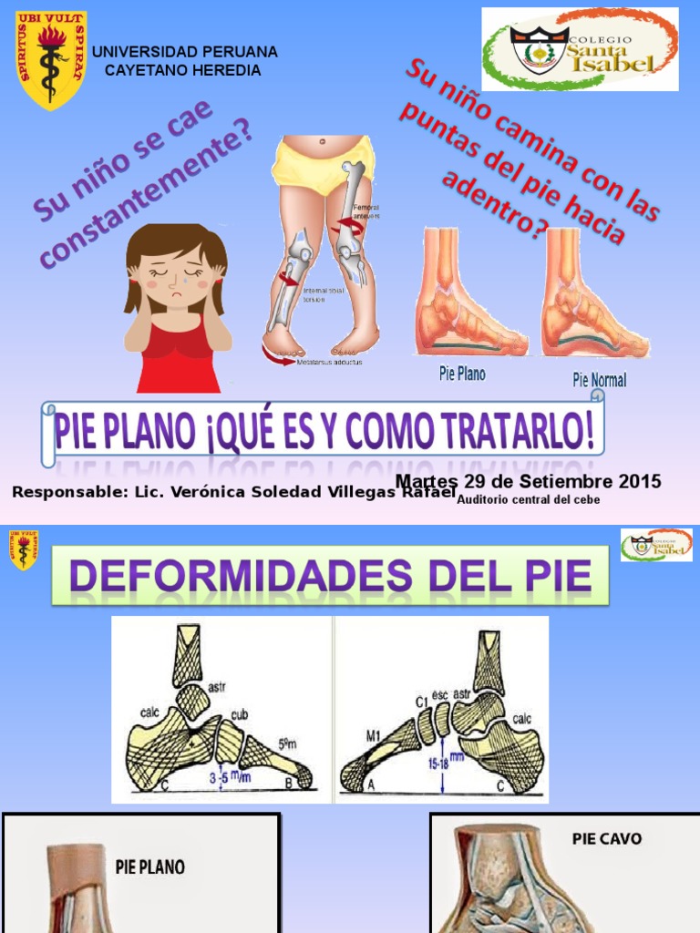 Pie Plano | PDF