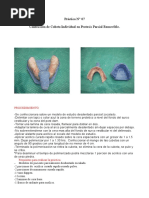 Festoneado en Odontología y Prótesis Total | PDF | Dentadura postiza ...