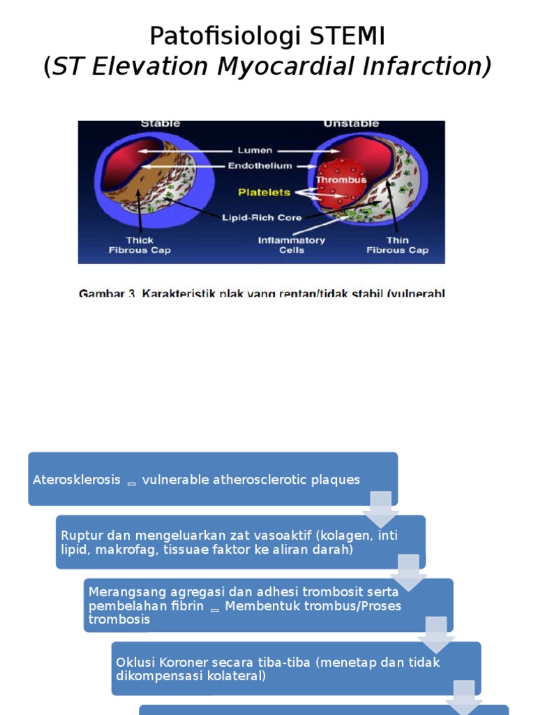 Patofisiologi STEMI | PDF