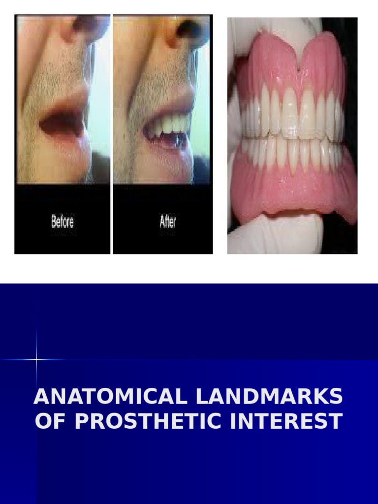 Extraoral Landmarks | Lip | Dentures