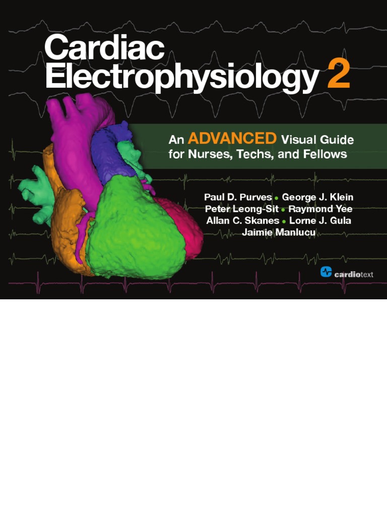 Cardiac Electrophysiology 2 An Advanced Visual Guide For Nurses Techs ...