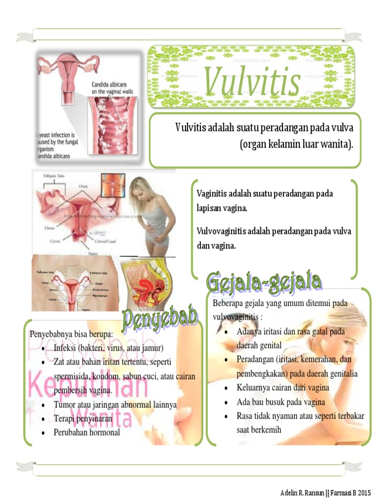 Penanganan Vulvitis dan Vaginitis | PDF