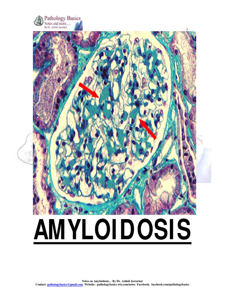Understanding Amyloidosis: Overview & Types | PDF | Amyloid | Anatomy