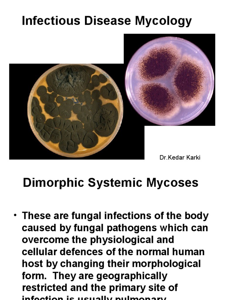 Infectious Disease Mycology | Aspergillus | Pneumonia