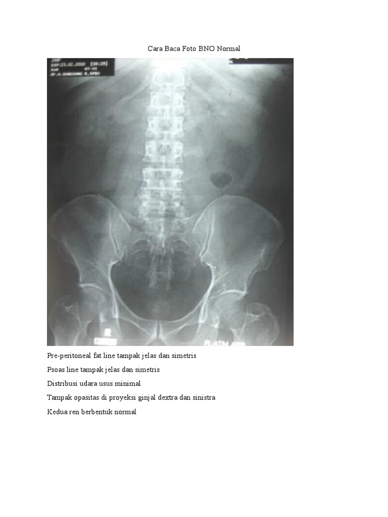 Cara Baca Foto BNO Normal | PDF