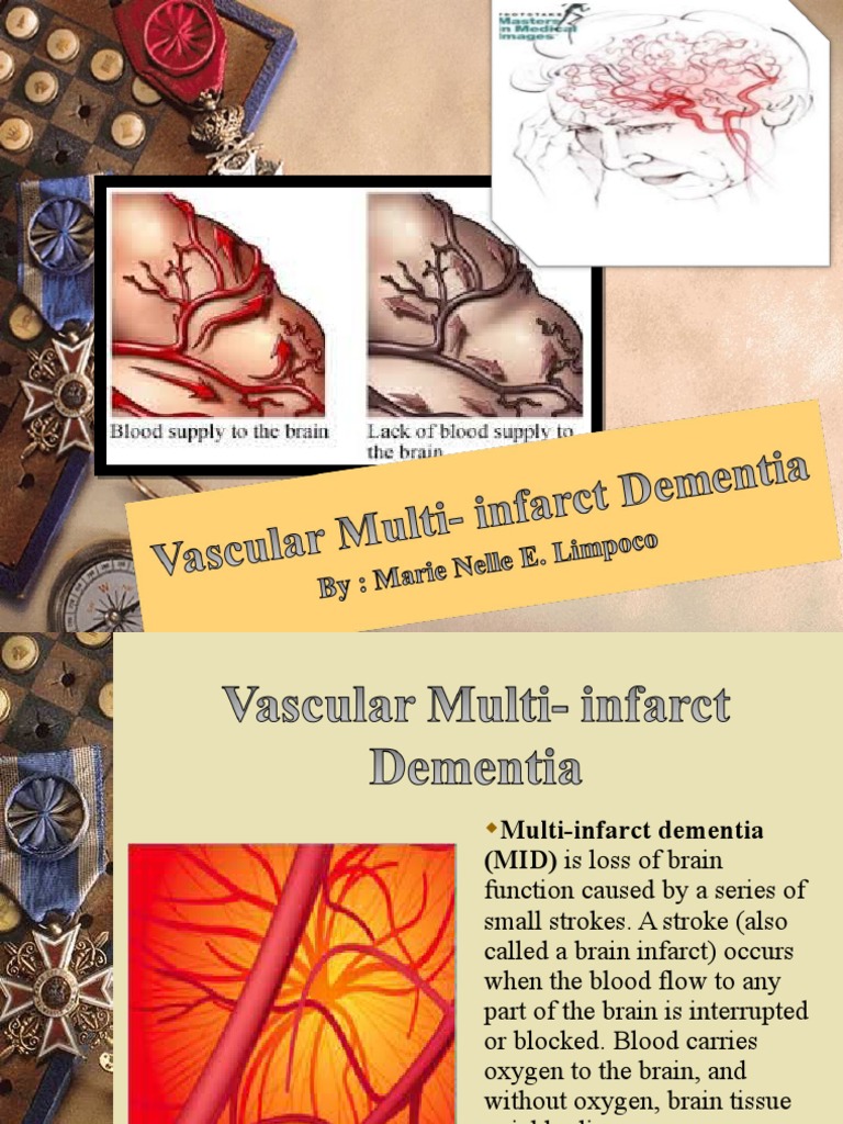 MUlti Infarct Dementia | PDF | Dementia | Stroke