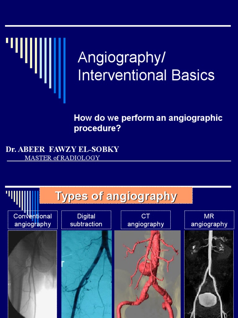 Angiography+Basics+and+Seldinger+Technique | Angiography | Medicine