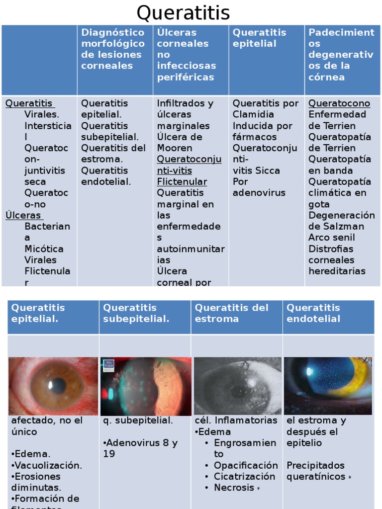 Queratitis | Especialidades Medicas | Oftalmología