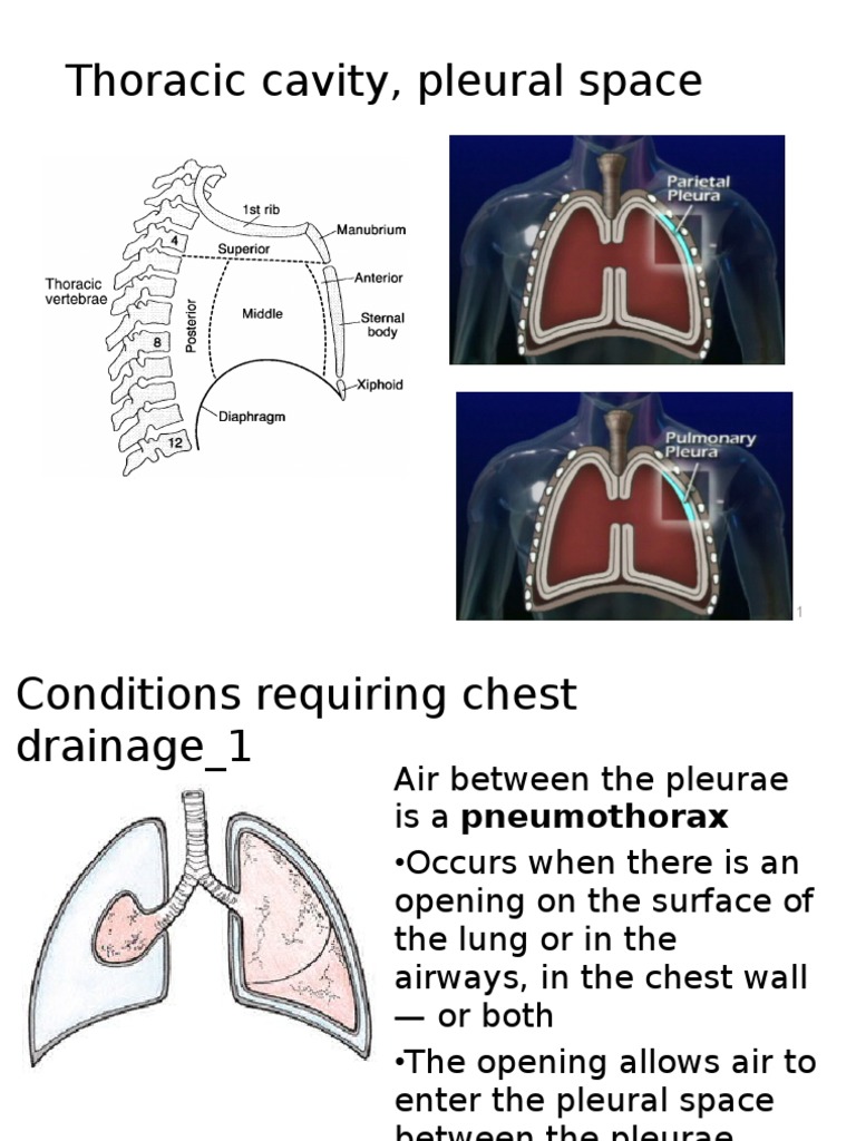 Understanding Chest Drainage Systems: A Comprehensive Review of Pleural ...